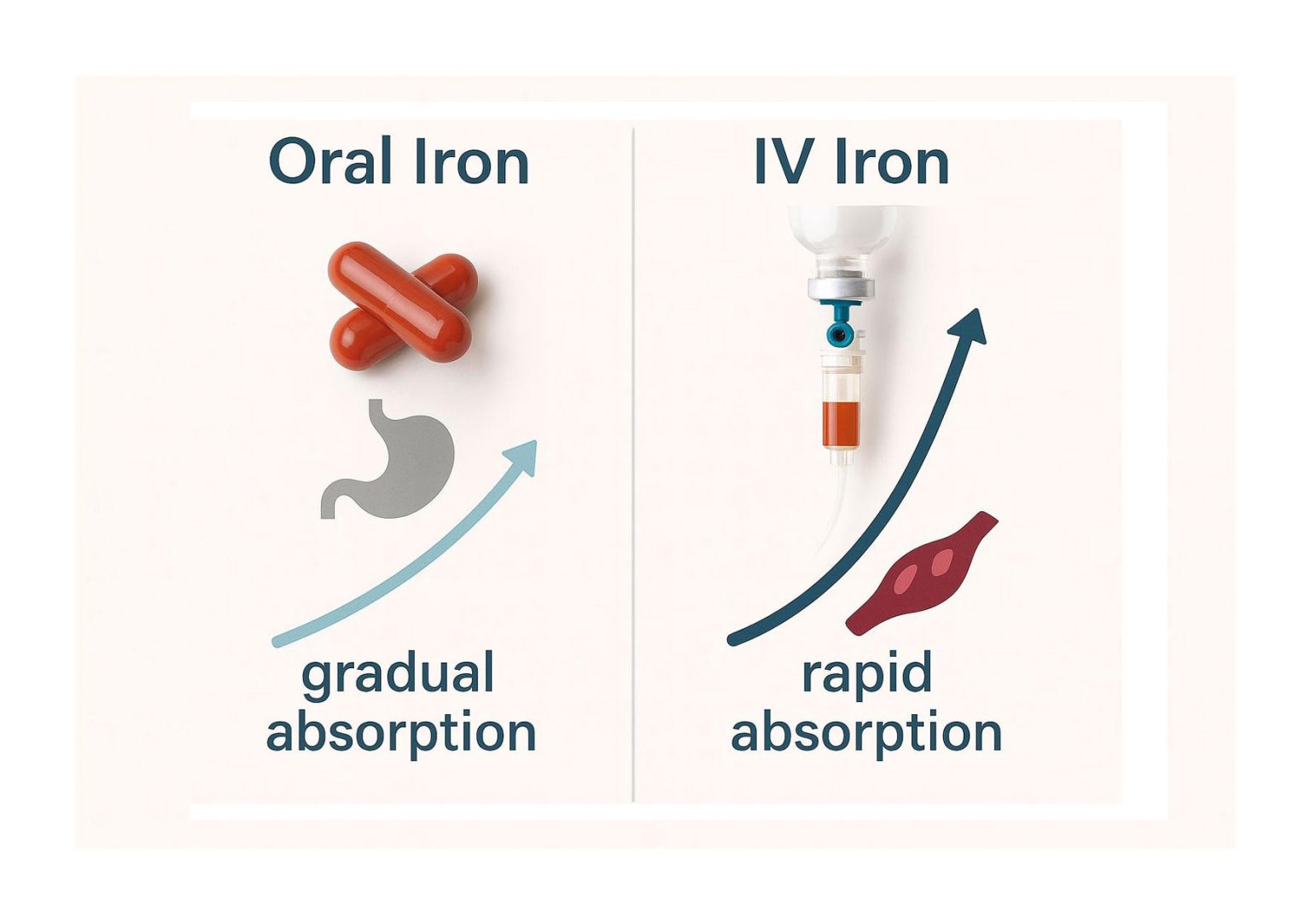Iron Infusions vs Oral Iron Supplements What’s the Difference